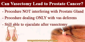 Vasectomy and Prostate Cancer – Beyond the link! - prostate